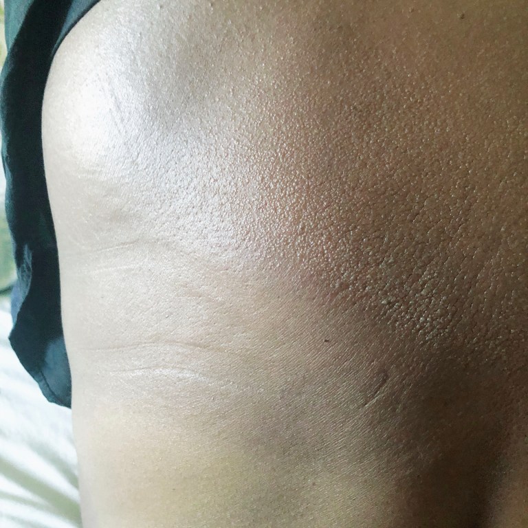 SUNBURN ON DARK SKIN: ‘MYTH’ OR ‘TRUTH’ – fabmommablog